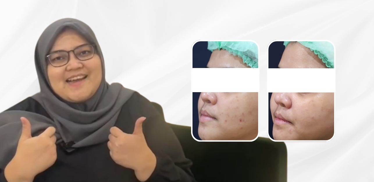 Review Perawatan di Ristra Clinic: Breakout pada Wajah Hilang, Kulit ...