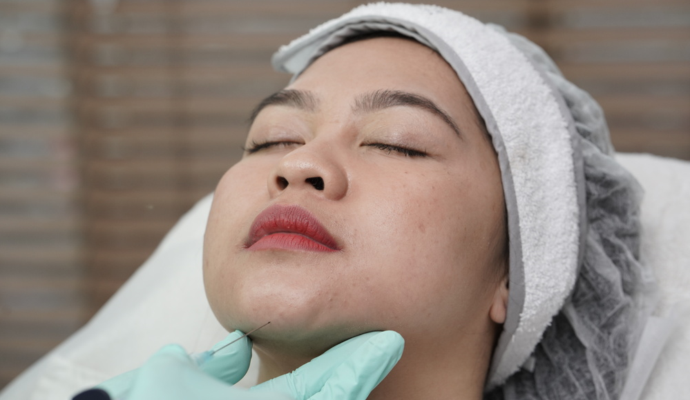 Suntik Filler: Definisi, Manfaat dan Panduan Prosedur Aman